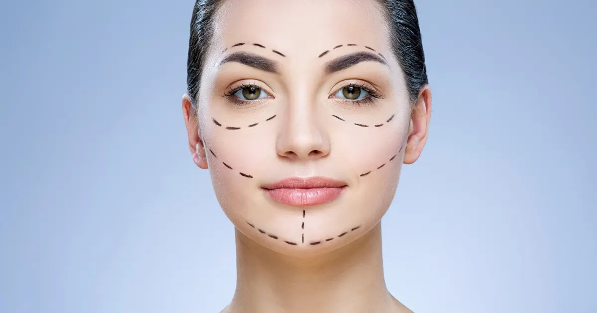 Tout ce qu’il y a à savoir au sujet du lipofilling du visage